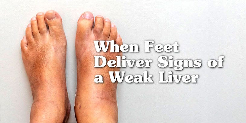 What Can Your Feet Tell You About Your Liver? – ENGLISH BOOT HOUSE